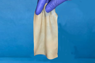 Pericardial patch – Dastavarde Sina